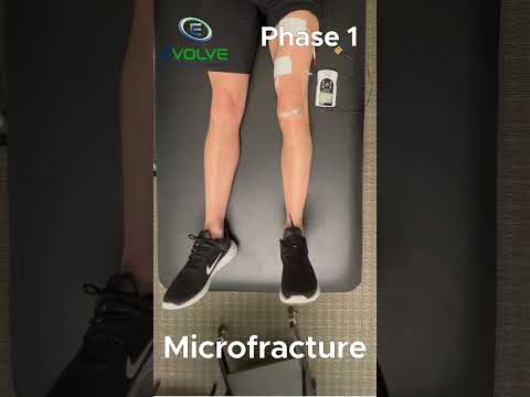 The Best Quadriceps Strengthening Exercise In Phase 1 Of Microfracture Rehab