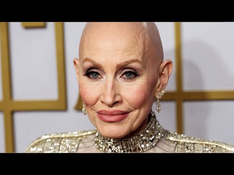 Dolly Parton Tried to Keep Her Disease a Secret, Now We Know