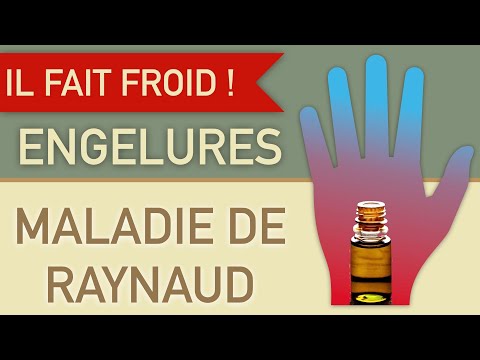 Engelures et maladie de Raynaud – PhytoGenfi
