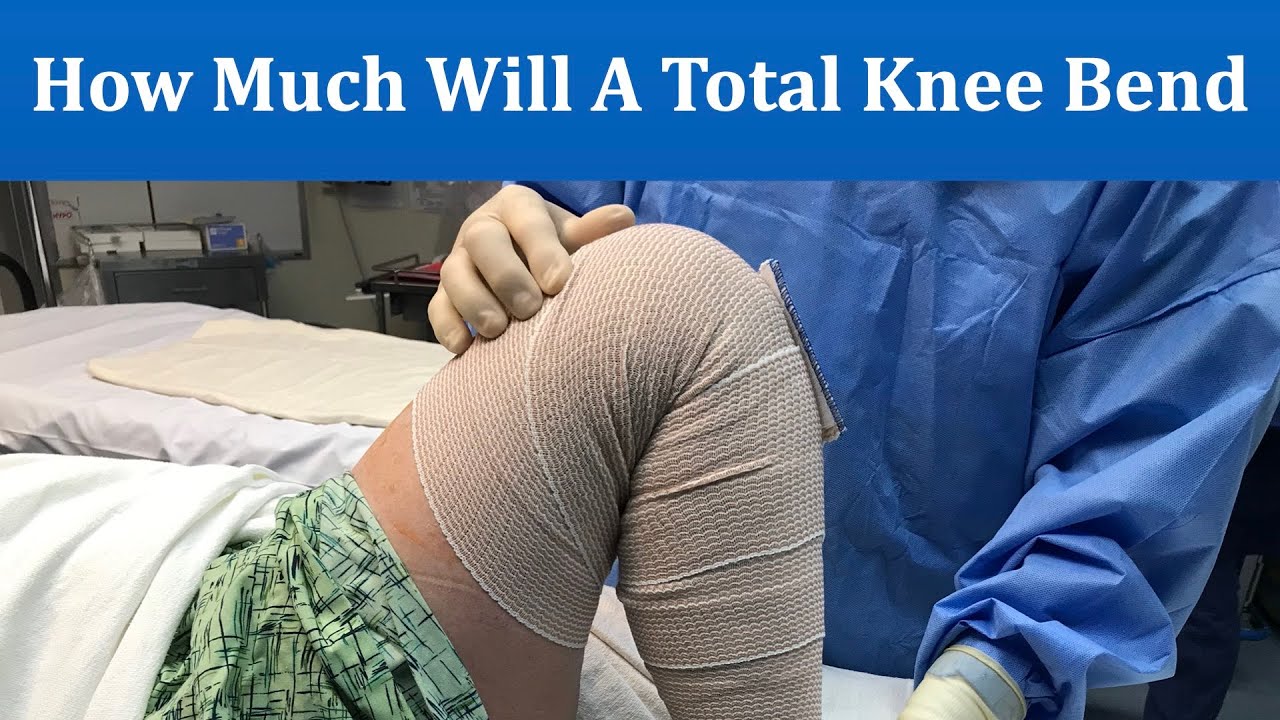 How much will a Total Knee bend? Getting the full range of motion from a knee replacement