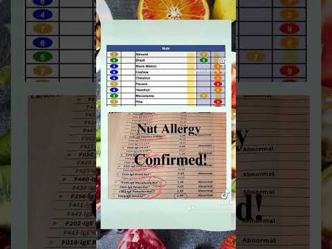 How Does AO Scan Compare To Blood Work?
