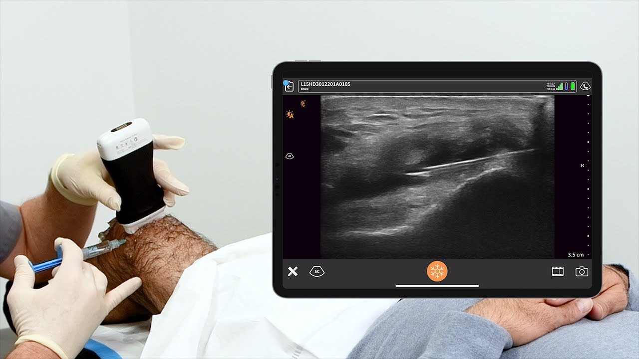 MSK AI and Knee Joint Injection