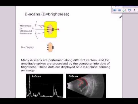 A level medical physics - ultrasound part 2 types of scan, A-scans, B-scans and M-scans
