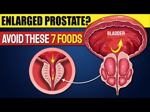 7 Foods To AVOID with an ENLARGED PROSTATE