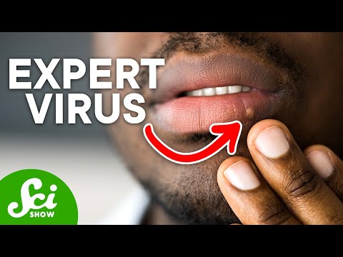 Why Herpes is Different From Other Viruses