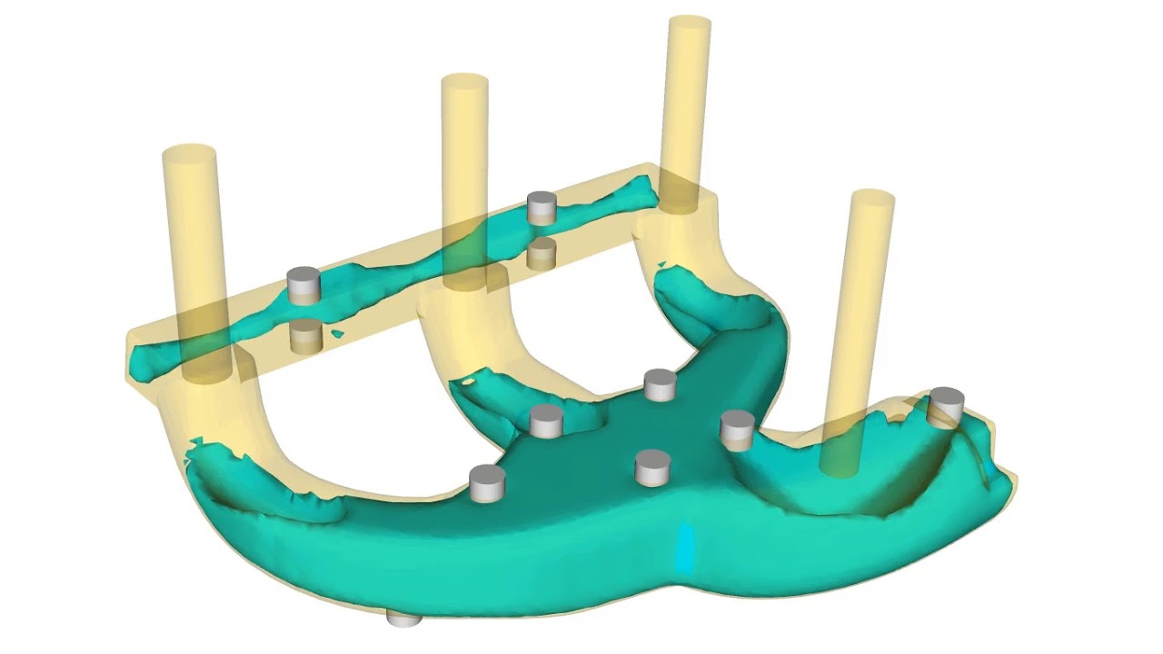 FLOW-3D CAST | State-of-the-Art Metal Casting Simulation