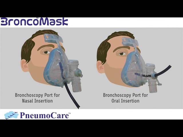 Cpap And Bipap Masks - Bronchoscopy NIV Mask Retail Trader from New Delhi