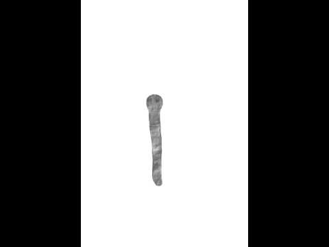 Plant Embryo Development revealed by DIC microscopy