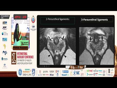 Pelvic Floor MR Anatomy
