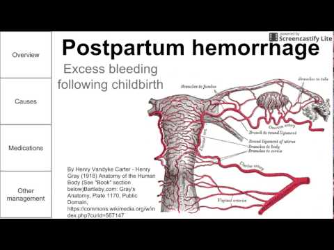 Postpartum hemorrhage