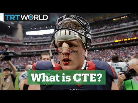 Brain disease found in 99% of deceased NFL players
