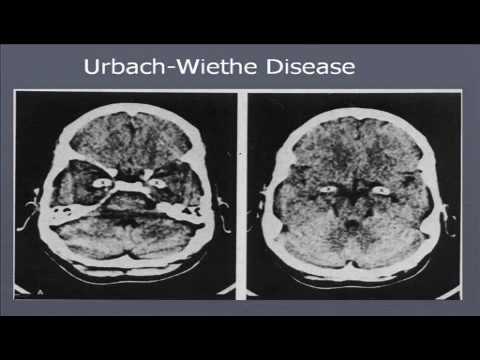 Dr Iain Jordan - The amygdala: From structure to function