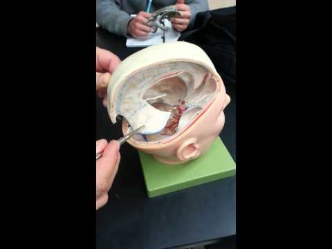 Neoroanatomy Dural folds and sinuses