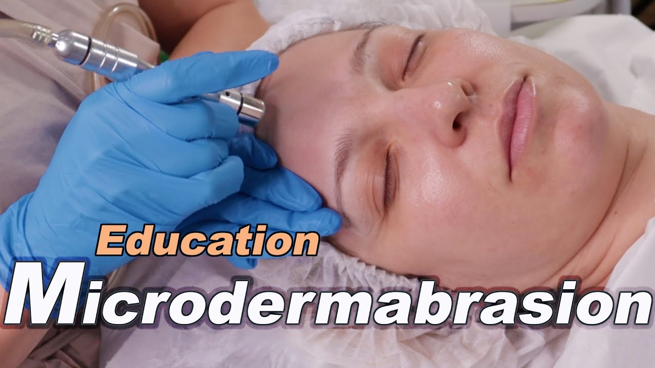 Microdermabrasion Facial - beauty tutor full demo , benefits and before and after pictures (2021)