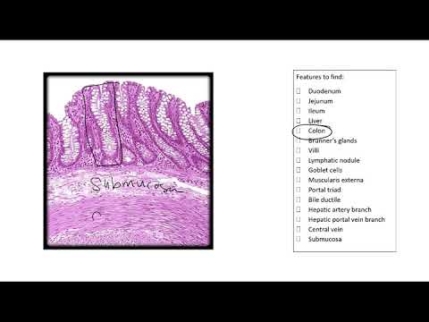 Digestive System APR worksheet review