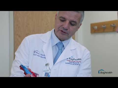 Daniel Marelli, MD - Cardiac Surgical Associates - Physician Bio