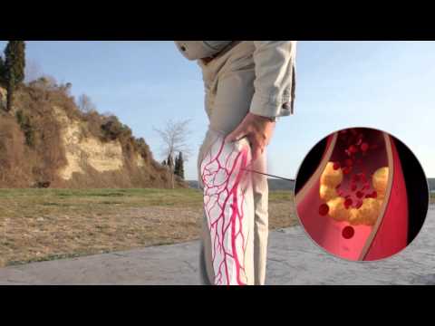 ABPI MD presentation video