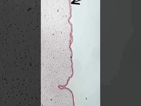 Umbilical cord -c sections # shorts #subscribe #trending #medical #earanatomy