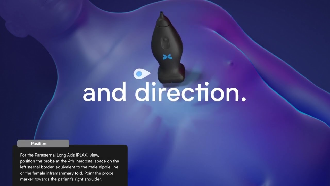 Introducing Butterfly ScanLab™ | Butterfly Network