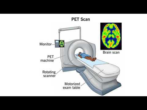 PET Scan vs SPECT Scan in 40seconds
