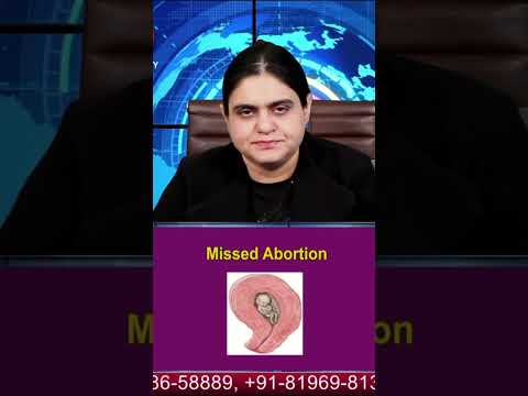 Uterus Cleaning Missed Abortion | Early Pregnancy Loss, Miscarriage | kya Pet ki Safai Jruri hai?