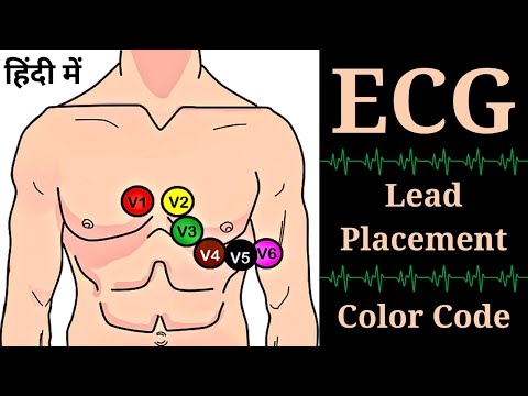 ECG in Hindi || 12 ECG Lead Placement || ECG Lead Color Code || ECG Lead Position || Nursing || GNM