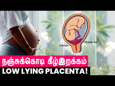 LOW LYING PLACENTA In Tamil | நஞ்சுக்கொடி கீழ்இரக்கம் | Dr. Priya Kalyani