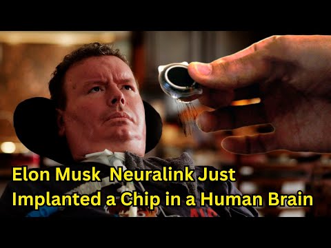 Elon Musk’s Neuralink Just Implanted a Chip in a Human Brain – Here’s What Happened
