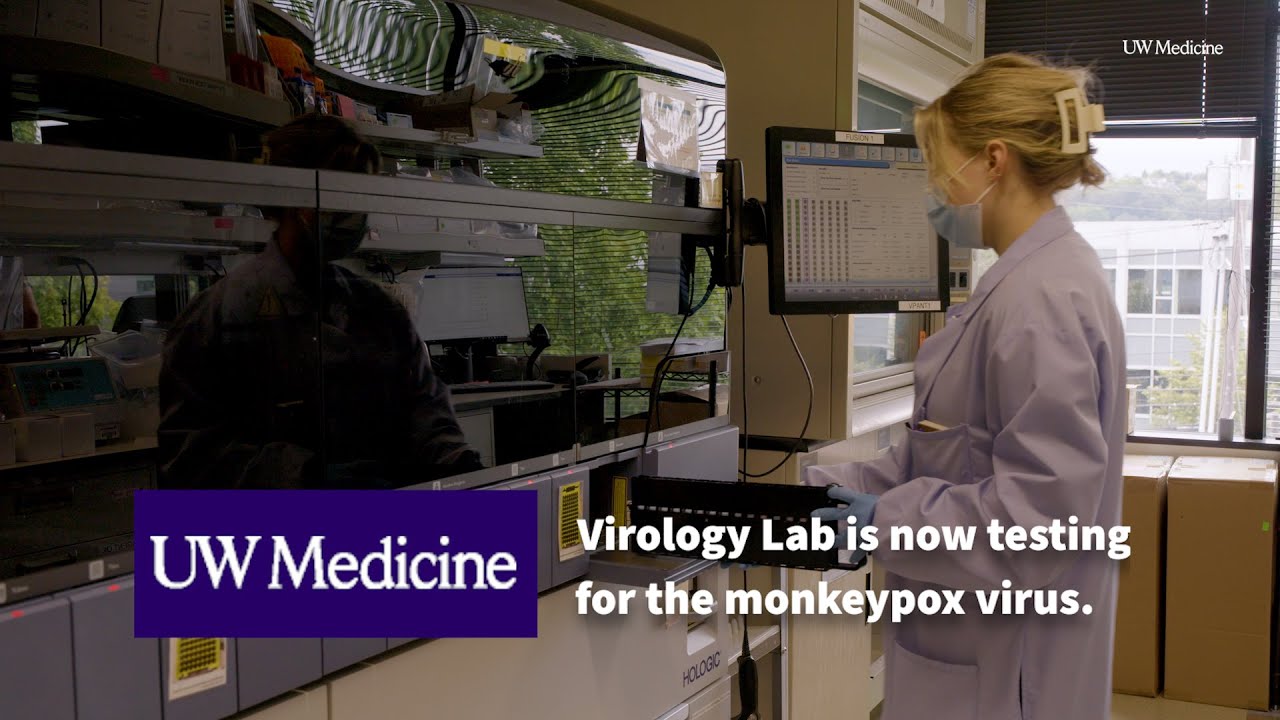 Testing for Monkeypox | UW Medicine