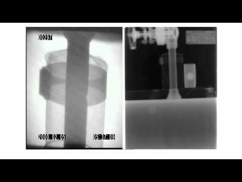 RTR_Real Time Radiography