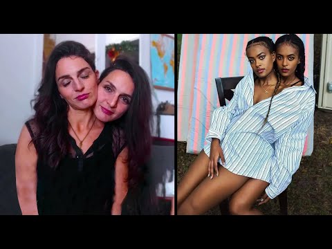 Most Unique Unusual Twins You Won’t Believe Exist | Entertainment ...