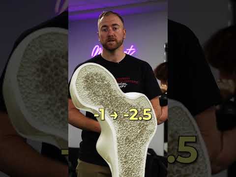 How To Determine Your Bone Density Results (DEXA Scan)