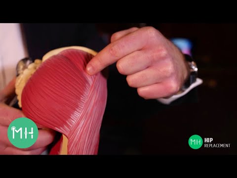What are the different options for hip replacement?