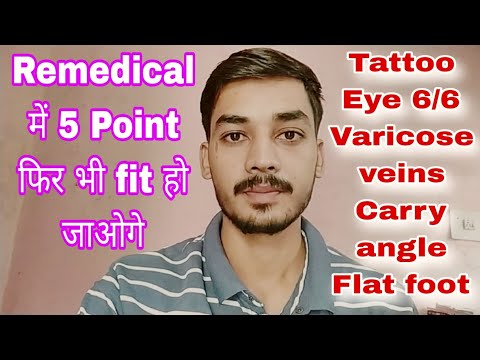 15/10/2024 Ssc gd Remedical review🥳Ssc gd Medical Review 15 october 2024🔥Ssc gd running 15 october