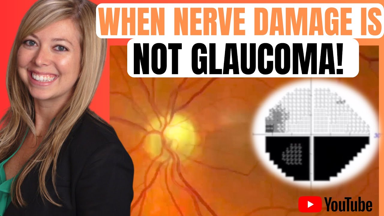 When Optic Nerve Damage is NOT Glaucoma! [Clinic PowerUp]