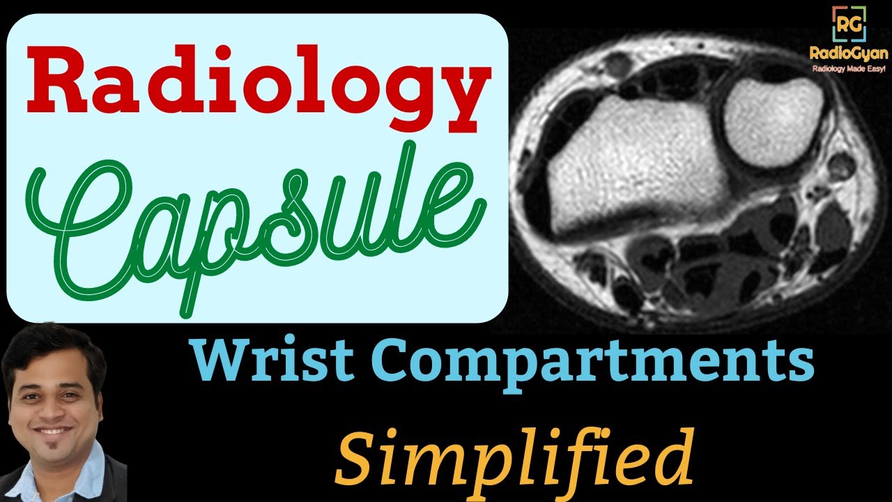 Wrist Extensor Compartments - Anatomy and Imaging Pathologies  | Radiology Capsules | Episode 1