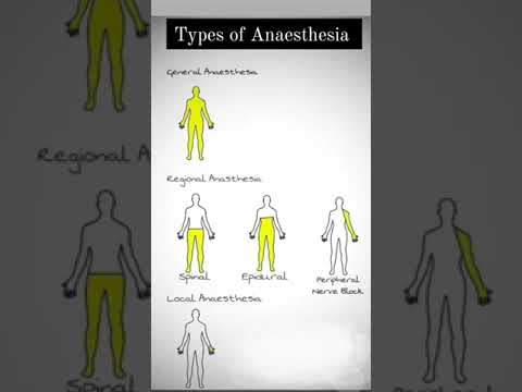 Types of anesthesia#shorts