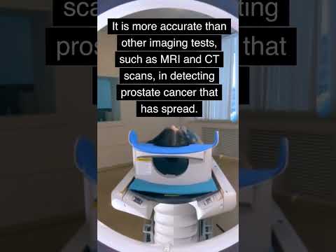 PYLARIFY® - (piflufolastat F 18) Injection PET/CT Imaging in Prostate Cancer Patient