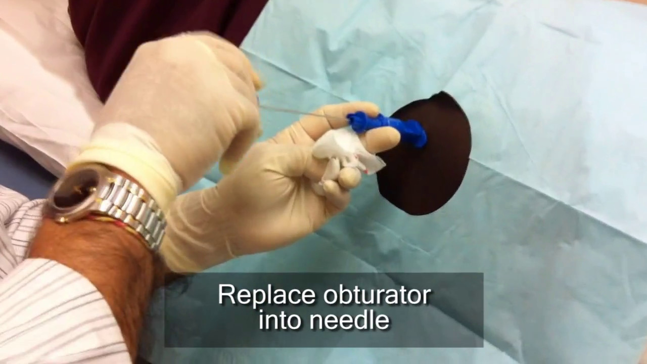 How To Do A Bone Marrow Aspiration & Biopsy