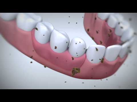 How does Fixodent denture adhesive work?