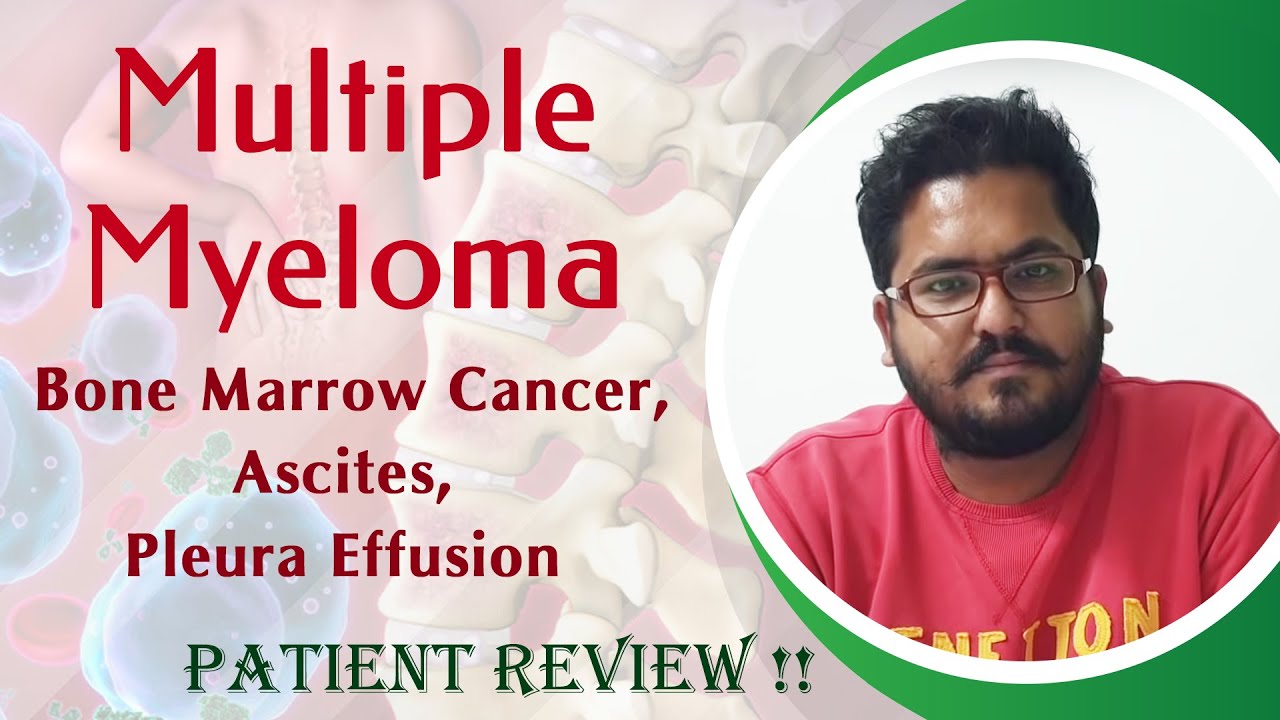 Multiple myeloma (Bone marrow cancer), Ascites, Pleural effusion - Patient Review !!