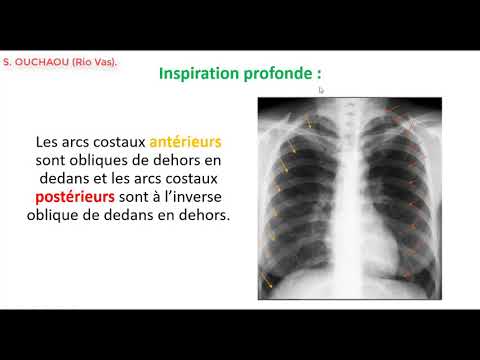 Comment interpréter une radiographie thoracique de face - Partie 1