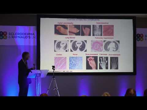 Chris Denton: BSR Guidelines and Annual Tests