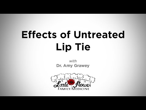 Effects of Untreated Lip Tie