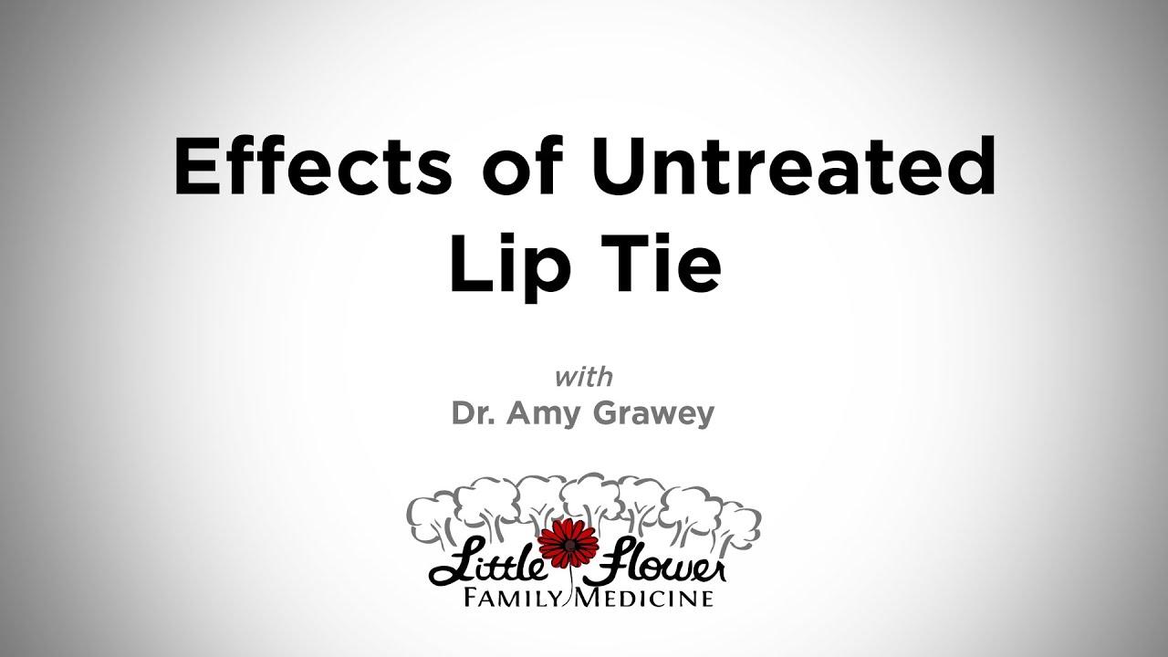 Effects of Untreated Lip Tie