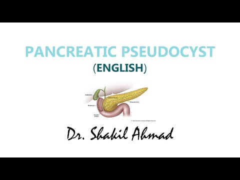 Pancreatic Pseudocyst (English)