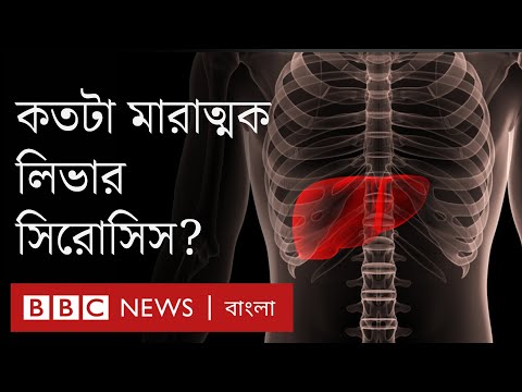 Liver Cirrhosis: লিভার সিরোসিস রোগের কারণ, লক্ষণ ও চিকিৎসা কী? | BBC Bangla