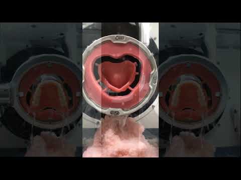 Digital meets Analog with BDS and Drake Dental Laboratory's DIGITAL DENTURE