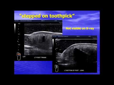 Pediatric Applications of Toshiba Ultrasound, Dr. Sally O'Hara