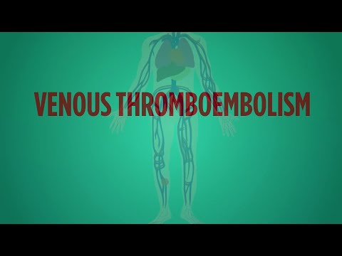 Venous Thromboembolism Explained in 60 Seconds